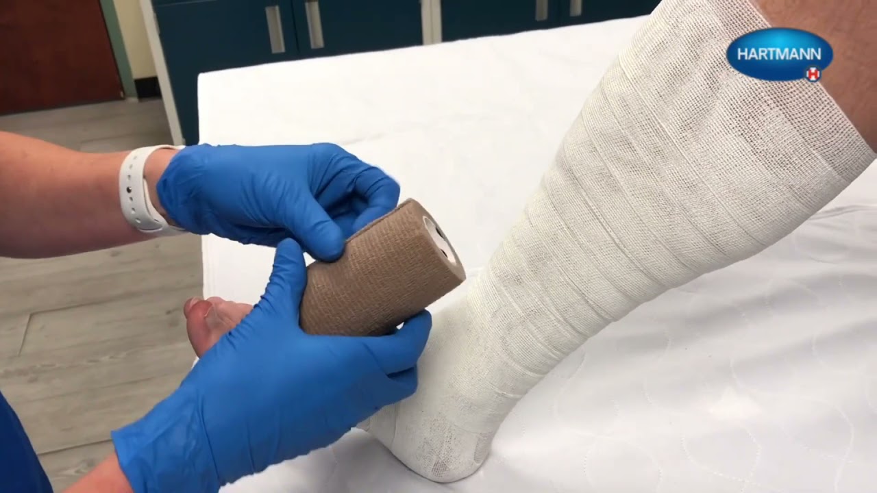 Hartmann-conco Econo-Paste Plus Calamine Unna Boot Bandage 4" x 10 yds ...