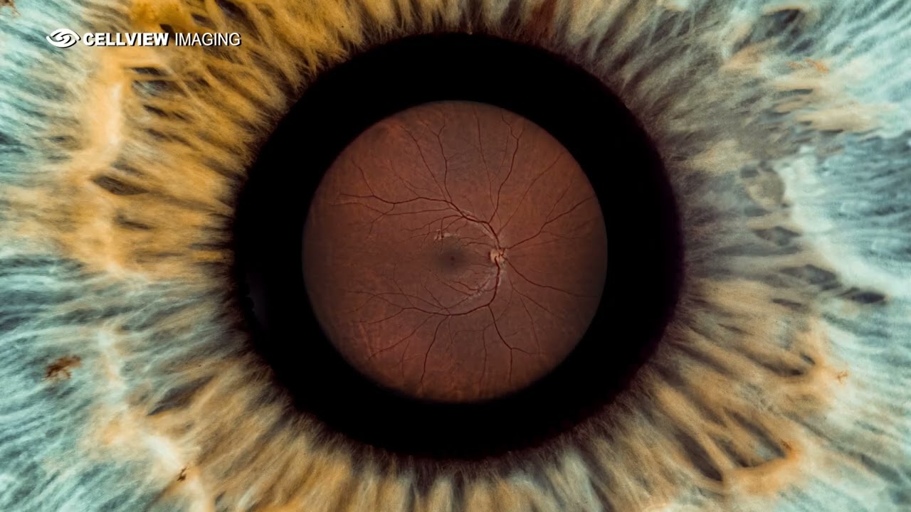 Cellview WRI-1 Retinal Imager