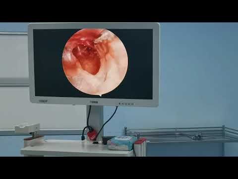 ENT Surgery