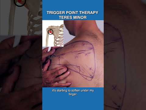 Releasing Teres Minor Trigger Points