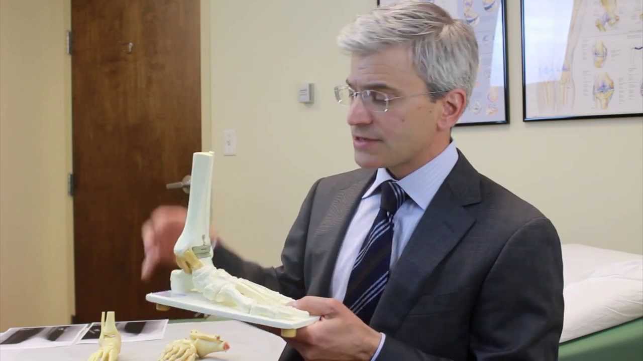 Ankle Replacement - Paul DeFrino, MD