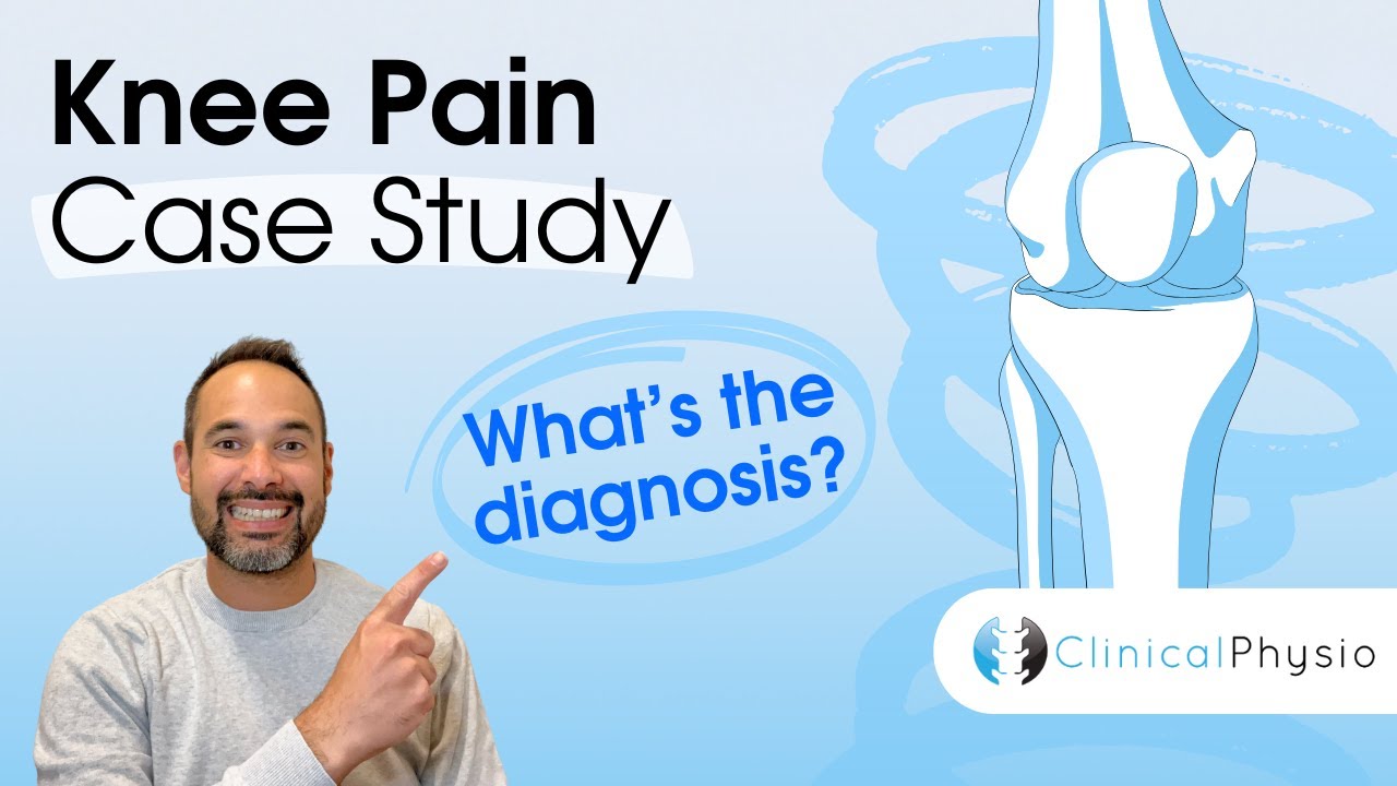 Knee Pain Case Study | Don't Miss This in Clinic!