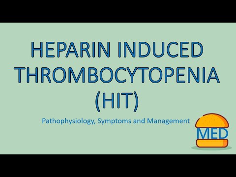 HEPARIN INDUCED THROMBOCYTOPENIA (HIT) made easy! Pathophysiology, Presentation and Management