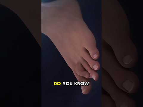 "Hammer Toe Surgery Explained 🔍 | Shocking Medical Procedure!" 🦶😱