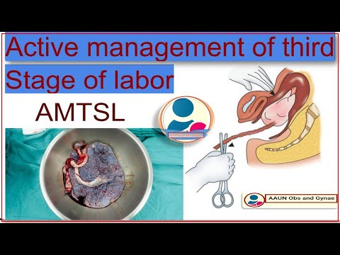 Active Management of Third Stage of Labour / AMTSL