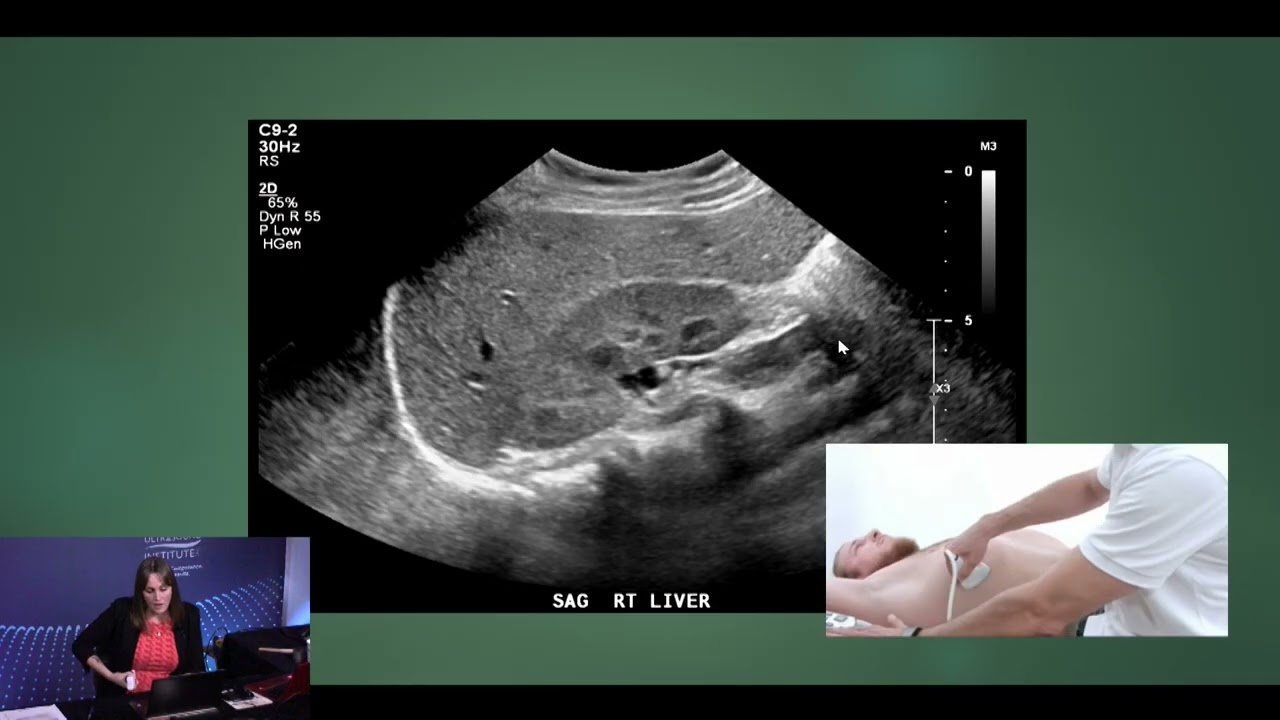 Normal Liver, Gallbladder, Biliary Tree, Spleen Sonography SAMPLE
