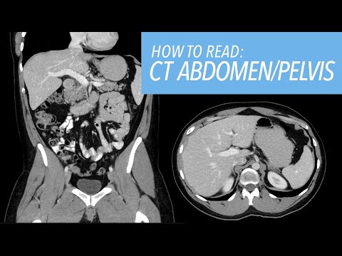 How to Read a CT Abdomen & Pelvis like a Radiologist: Introductory Approach and Basic Search Pattern