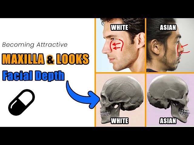 Understanding the Maxilla: The Key to Facial Attractiveness and Depth ...