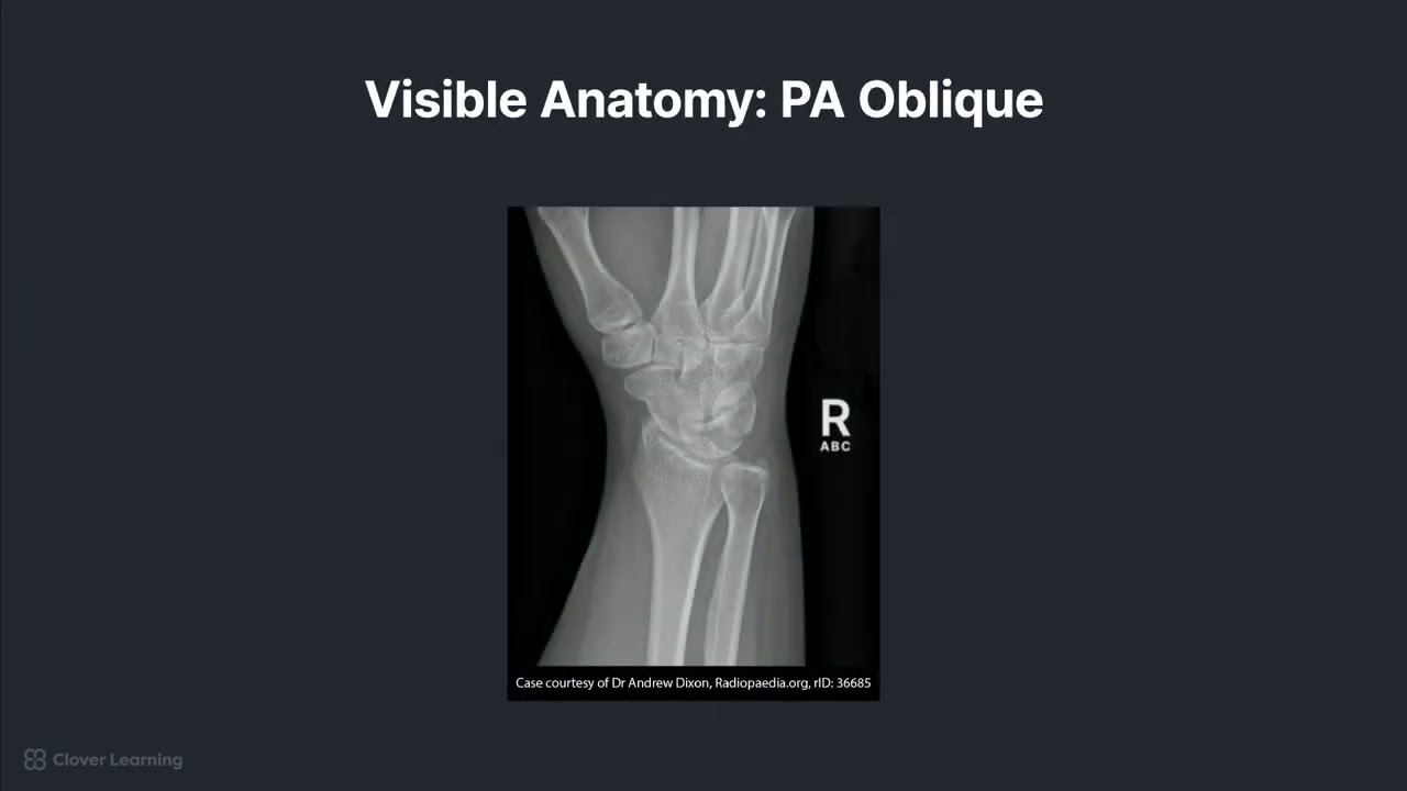 How to Recognize Key Anatomy on Wrist Radiographs