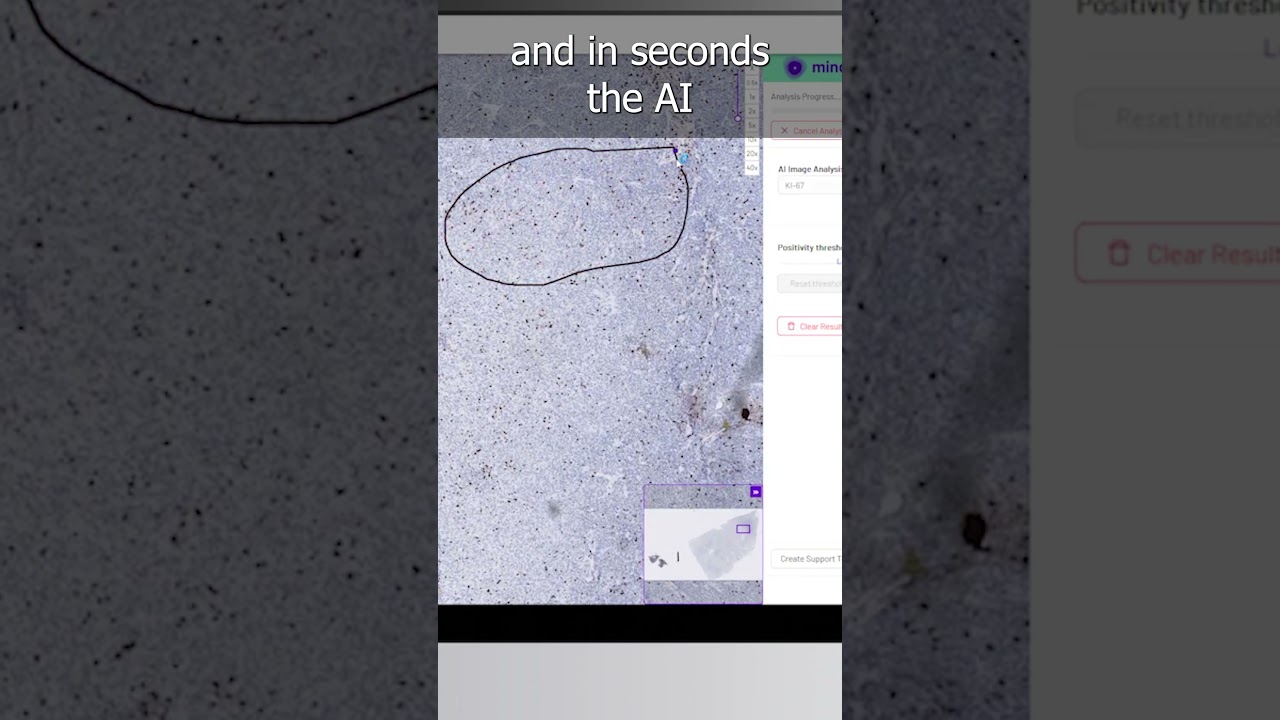 Artificial Intelligence | Digital Pathology in 60 Seconds #digitalpathology #AIinHealthcare