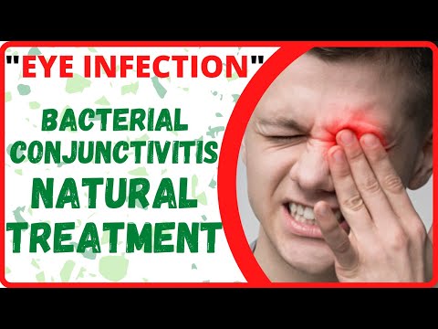 Bacterial Conjunctivitis | Bacterial Eye Infection Natural Treatment