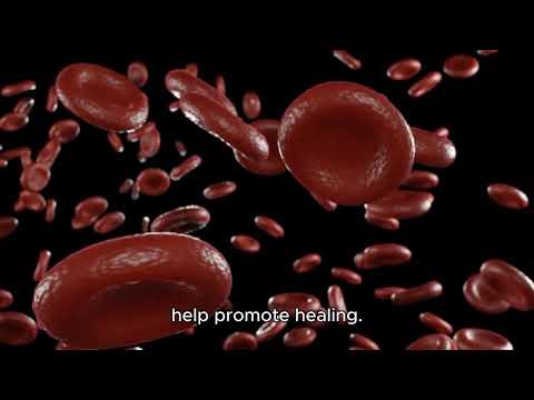 PRP: CARPAL TUNNEL