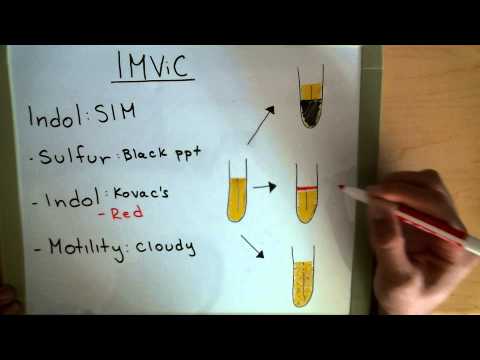 IMViC | Indole | MR-VP | Citrate | Microbiology Lab