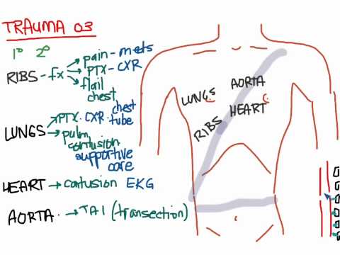 Chest Trauma – Rush Emergency Medicine