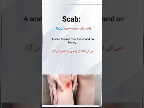 Scab meaning #scab sentence #
