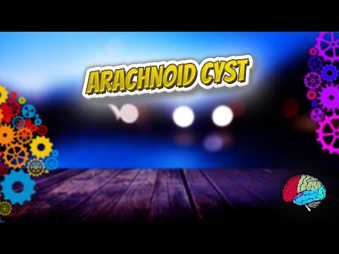 Arachnoid cyst - Know It ALL 🔊✅