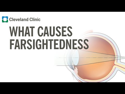 What Causes Farsightedness?