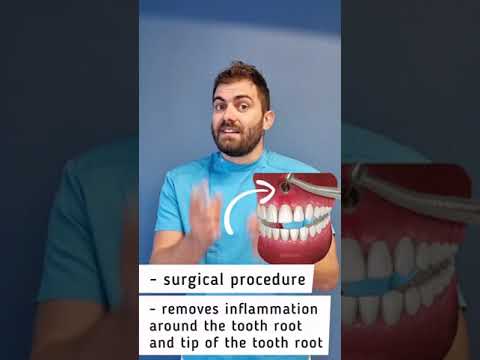 What is apicoectomy?