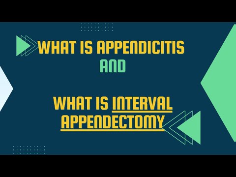What is Interval appendectomy/ why should we do it?