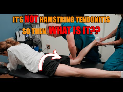 Lainie's Bilateral Sit Bone Pain Isn't Hamstring Tendonitis, SHE HAS THIS!!