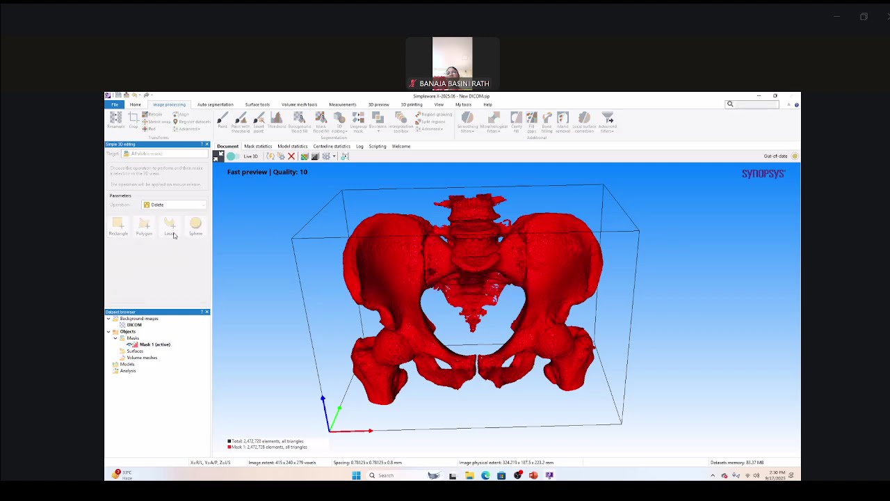Synopsys Simpleware Software Demo | 3D Image Processing & Modeling
