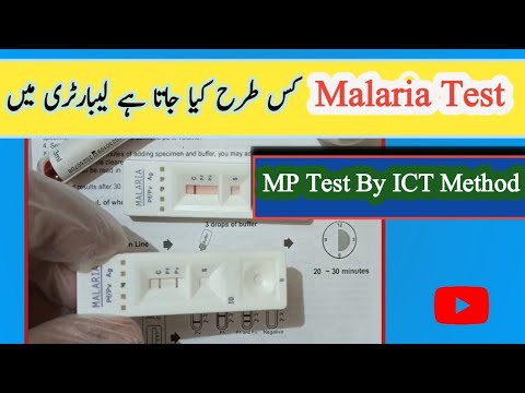 Malaria Antigen Test by Strip Method. How to Perform MP test in Laboratory Urdu/Hindi...
