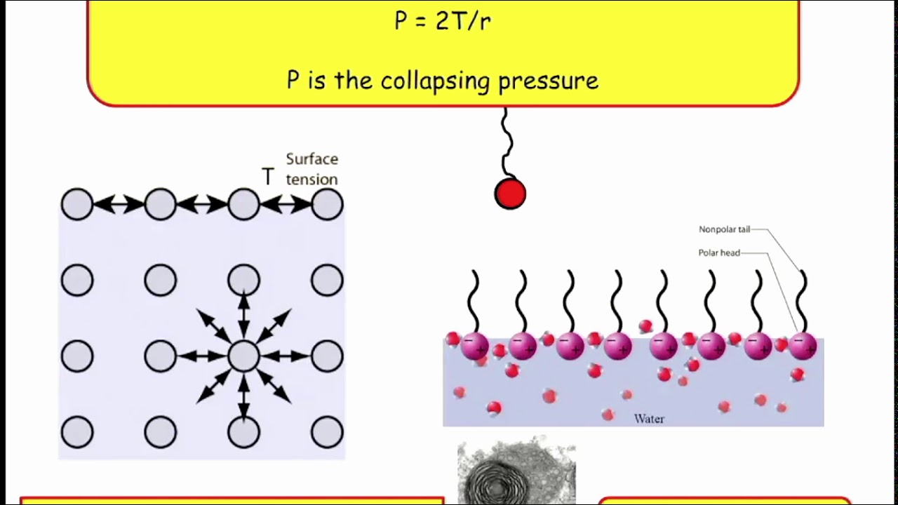 12DaysinMarch, Podcast Series, Surfactant for the USMLE Step One Exam
