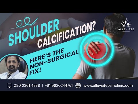 Non-Surgical Solutions for Calcific Tendinitis Revealed!