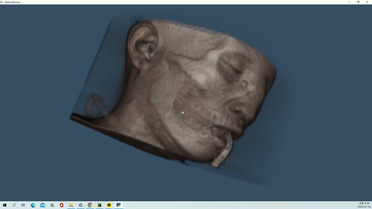 VTK Python Example - MedicalDemo4