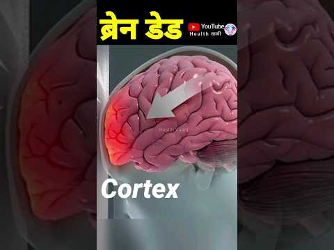 What is brain death #coma #braindeath #brain #medical3d #doctors