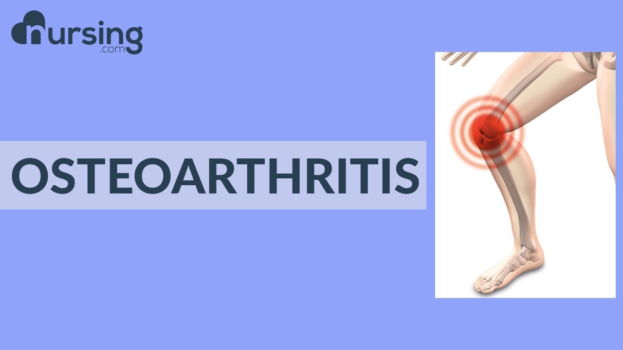 Osteoarthritis (Nursing School Lessons)