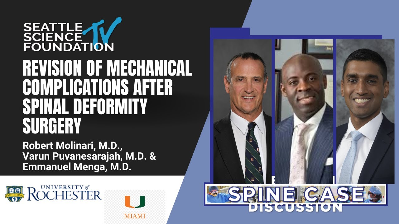 Revise - Spinal deformity Surgery - Emmanuel Menga, MD, Varun Puvanesarajah, MD, Robert Molinari, MD
