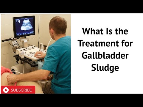 What Is the Treatment for Gallbladder Sludge