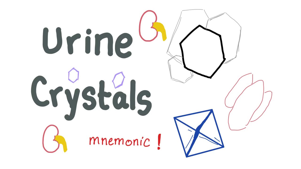 Urine Crystals (Kidney Stones) with a mnemonic