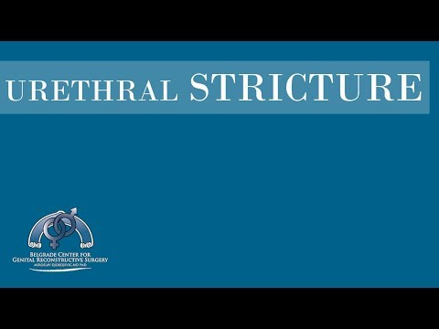 Urethral Strictures: Symptoms, Treatment Options, Cases
