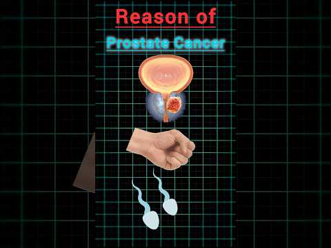 Reason of prostate cancer♋