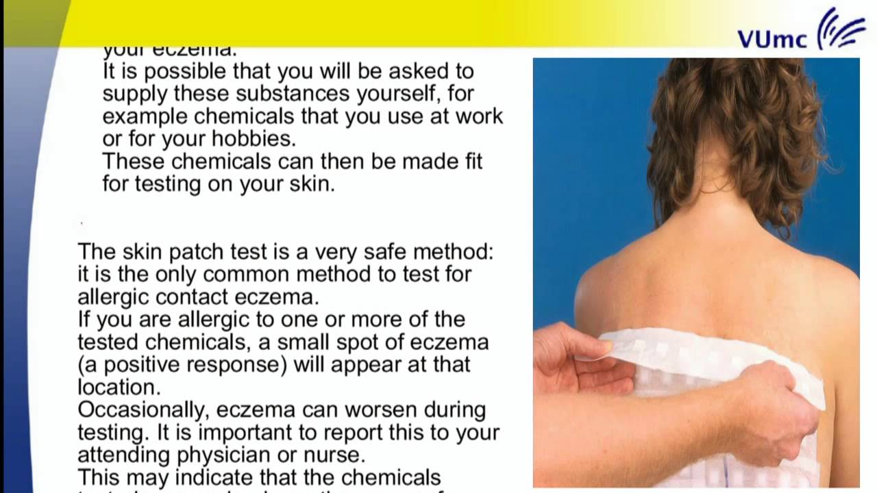 VUmc patient leaflet: allergy exam. Read in English