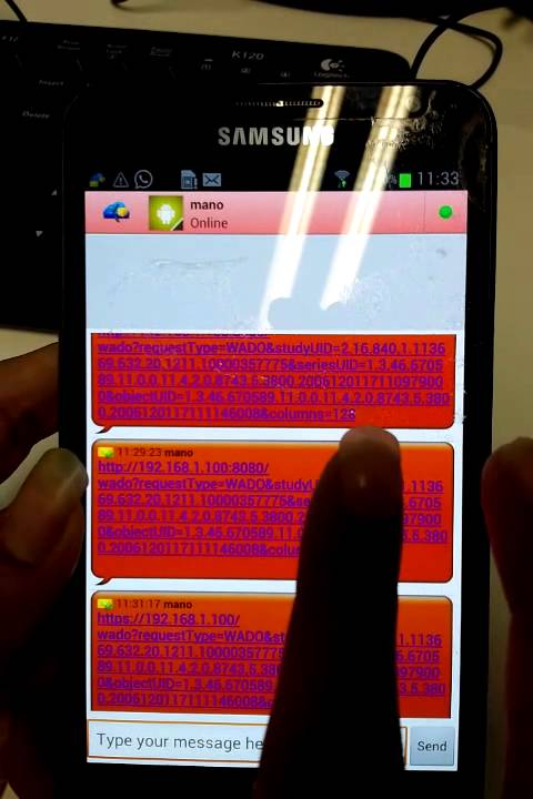 Dicom (Wado) Image viewing on phone and Weasis viewer