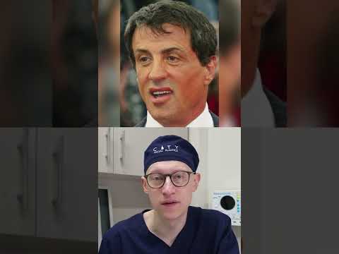 Sylvester Stallone Plastic Surgery Analysis