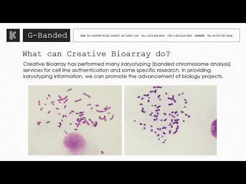 Karyotyping(G Banded)Service