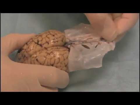 Sheep Brain Dissection - Center for Science Education