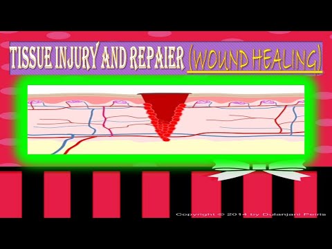 Physiology of Wound Healing (tissue healing) | Full Explanation in Hindi | By N.G. Medicals