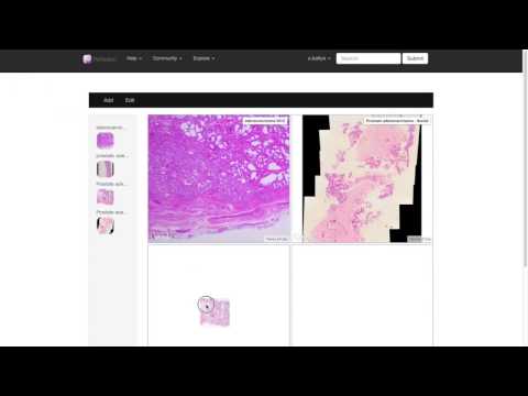 Pathobin pathology case presentation tool and windows viewer