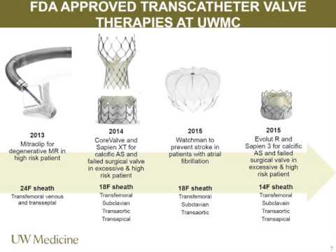 Catheter-Based Therapies for Structural Heart Disease