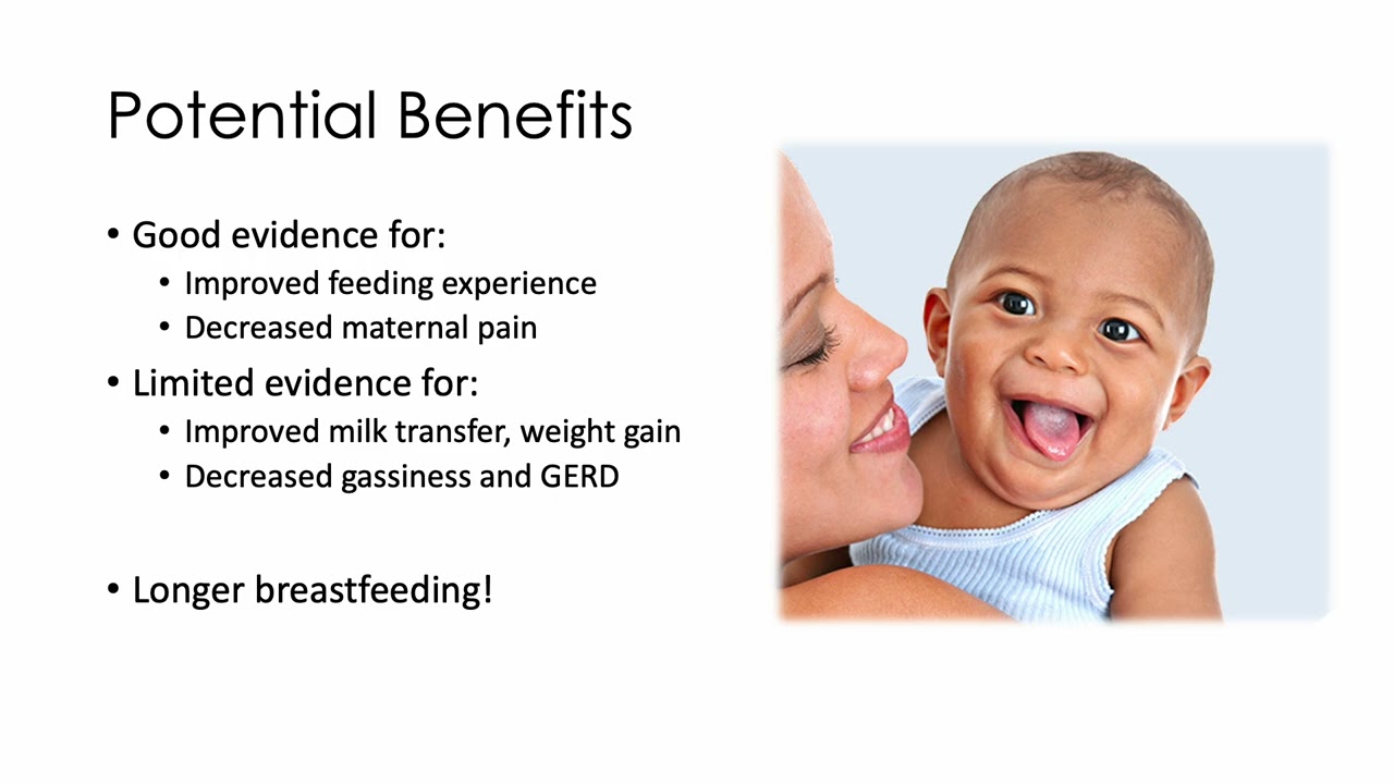 Tongue Tie, Lip Tie, and Breastfeeding: Understanding the Impact and Treatment Options | URMC