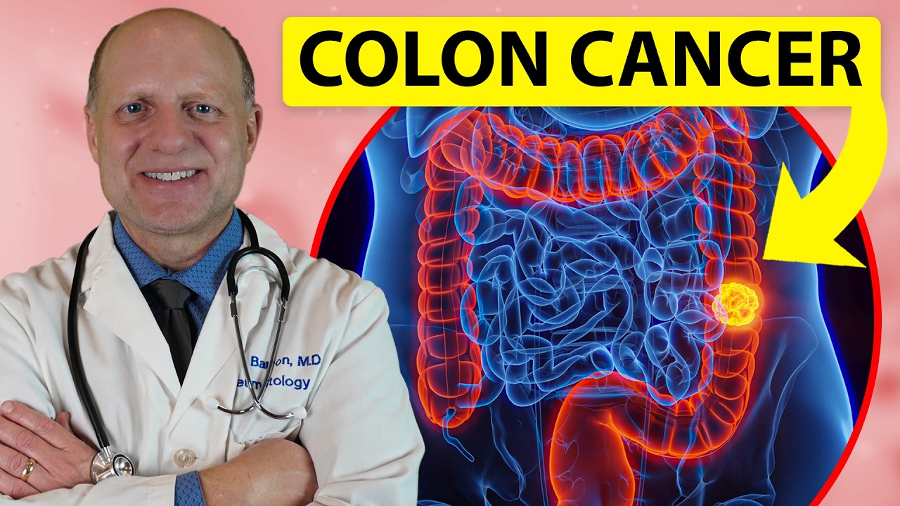 Colon Cancer, 10 Warning Signs- Doctor Explains