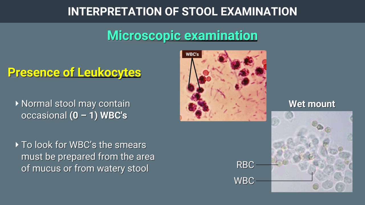 Interpretation of Stool Examination