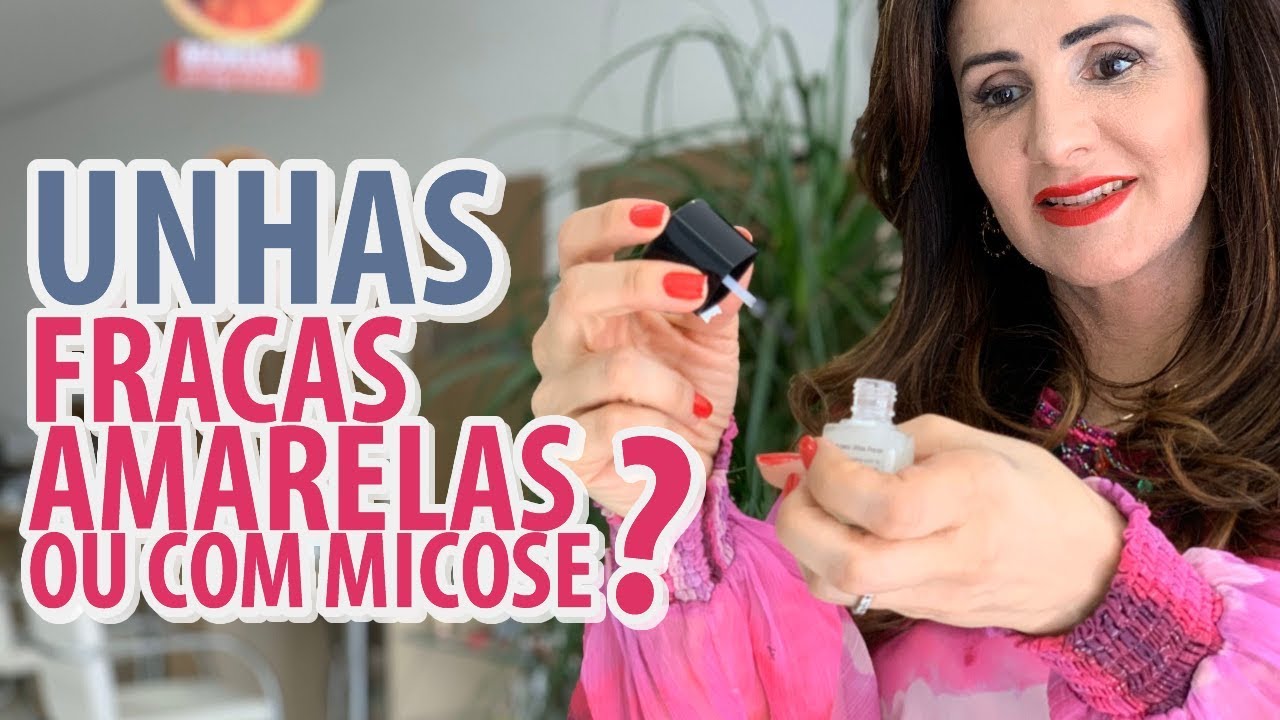 Você tem unhas fracas, amareladas ou com micose?