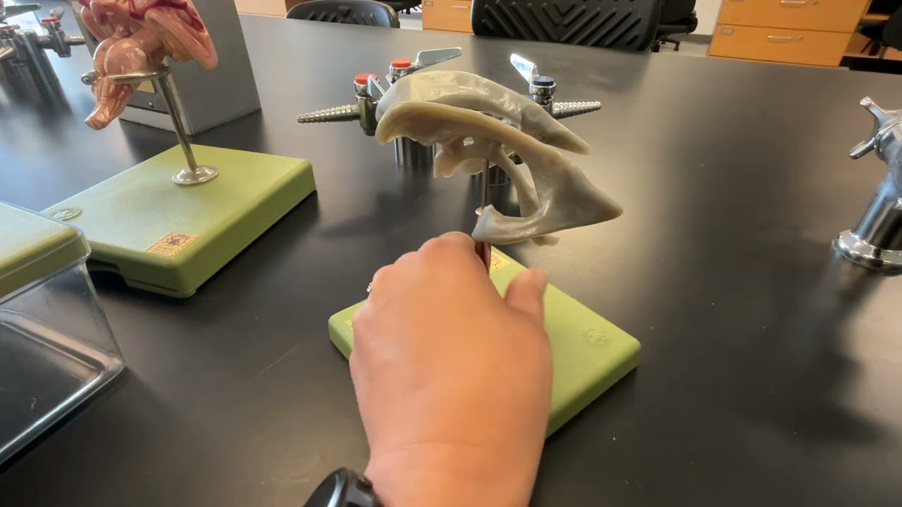 Lab 18: Ventricles
