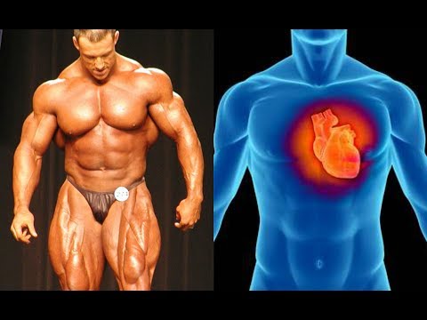 10 Bodybuilders who Died of Heart Attacks before 50